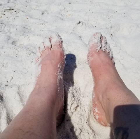 Imperfect Feet - myimperfectfeet OnlyFans